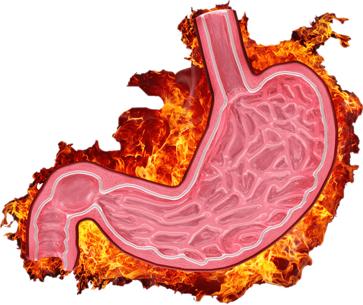 Blog: Acid Reflux